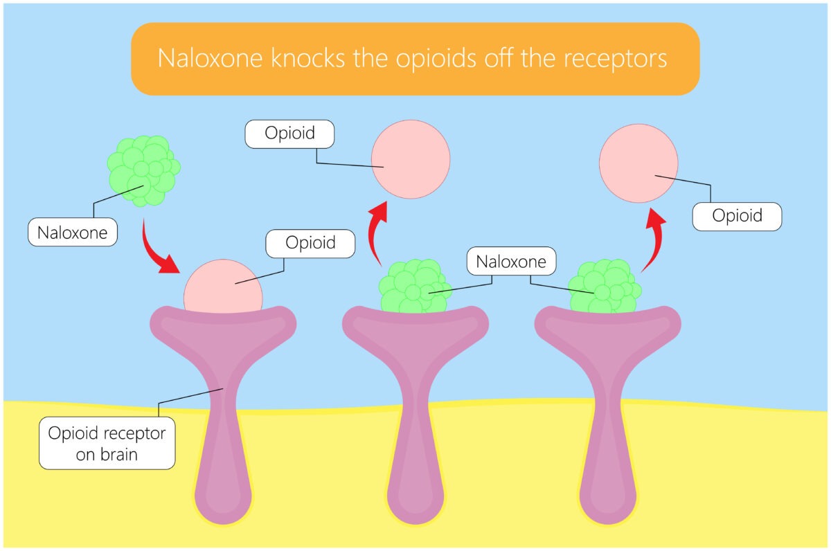 What Is Narcan Brooks Healing Center